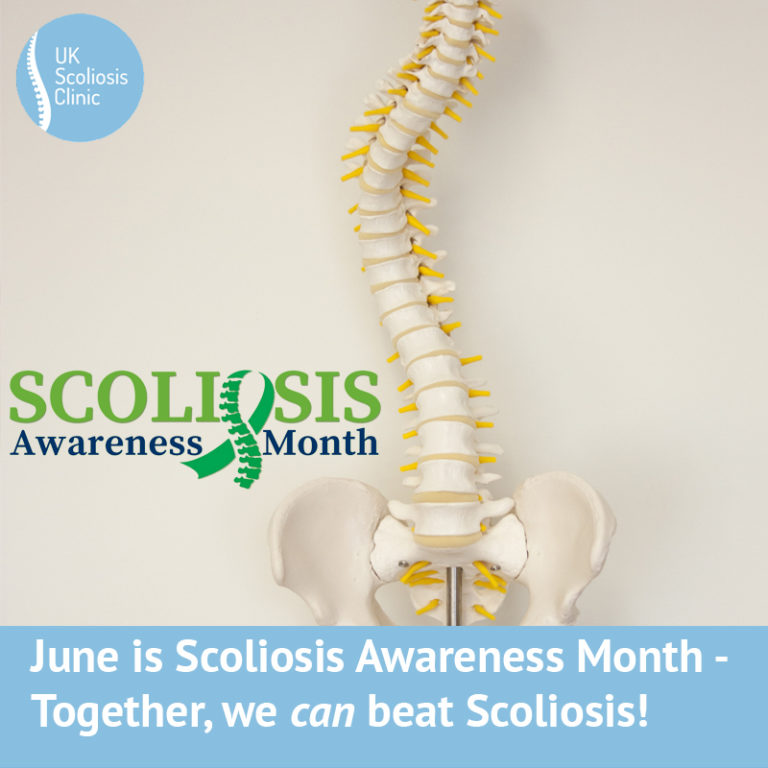 scoliosis awareness Archives - Scoliosis Clinic UK - Treating Scoliosis ... scoliosis awareness Archives - Scoliosis Clinic UK - Treating Scoliosis ...