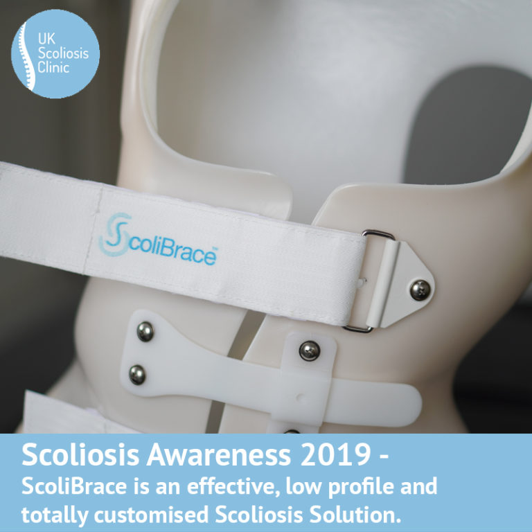 A scoliosis Journey – Week 3 - Scoliosis Clinic UK - Treating Scoliosis ...