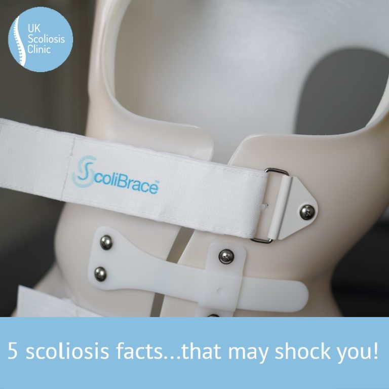 5 scoliosis facts that may shock you! - Scoliosis Clinic UK - Treating ...